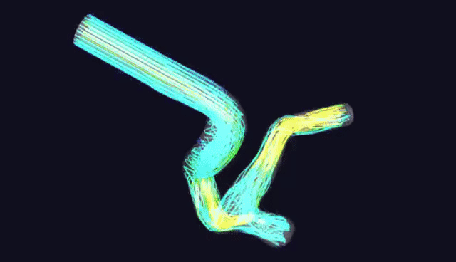 ArteryFlow